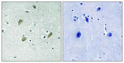 Casein Kinase Iγ1/2/3 rabbit pAb